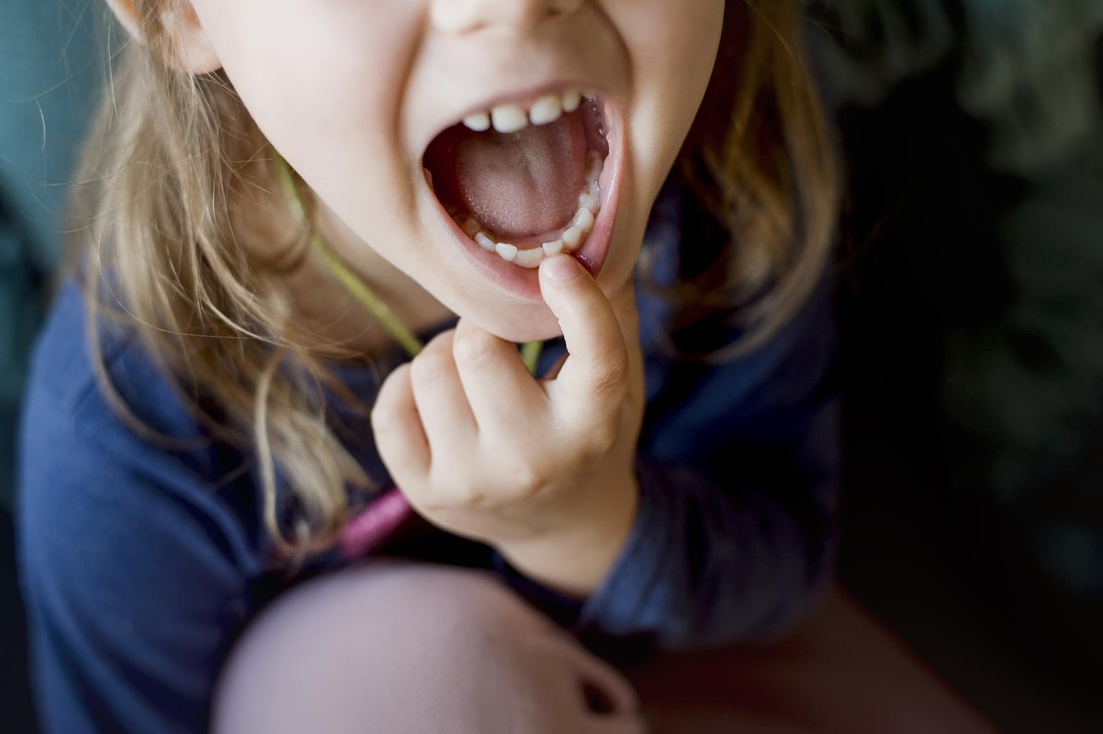 Baby Teeth: Should They Be Removed? | Miami FL Pediatric Dentist